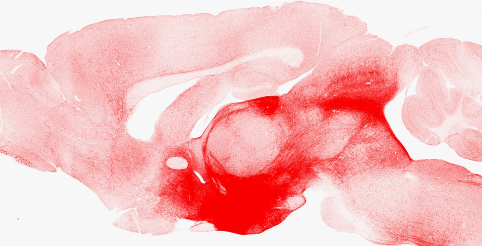 Zhou Lab | Anesthesia